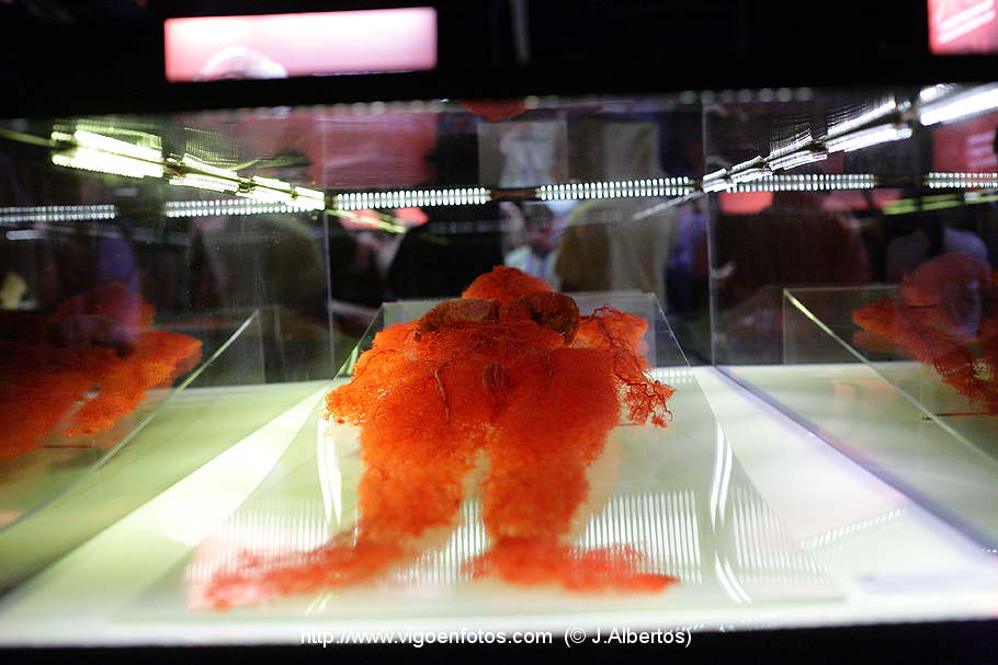 PHOTOS OF PLASTINATION EXHIBITION. ANATOMY - VIGO BAY. GALICIA. VISIT ...
