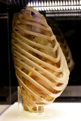 PHOTOS OF PLASTINATION EXHIBITION. ANATOMY - VIGO BAY. GALICIA. VISIT ...
